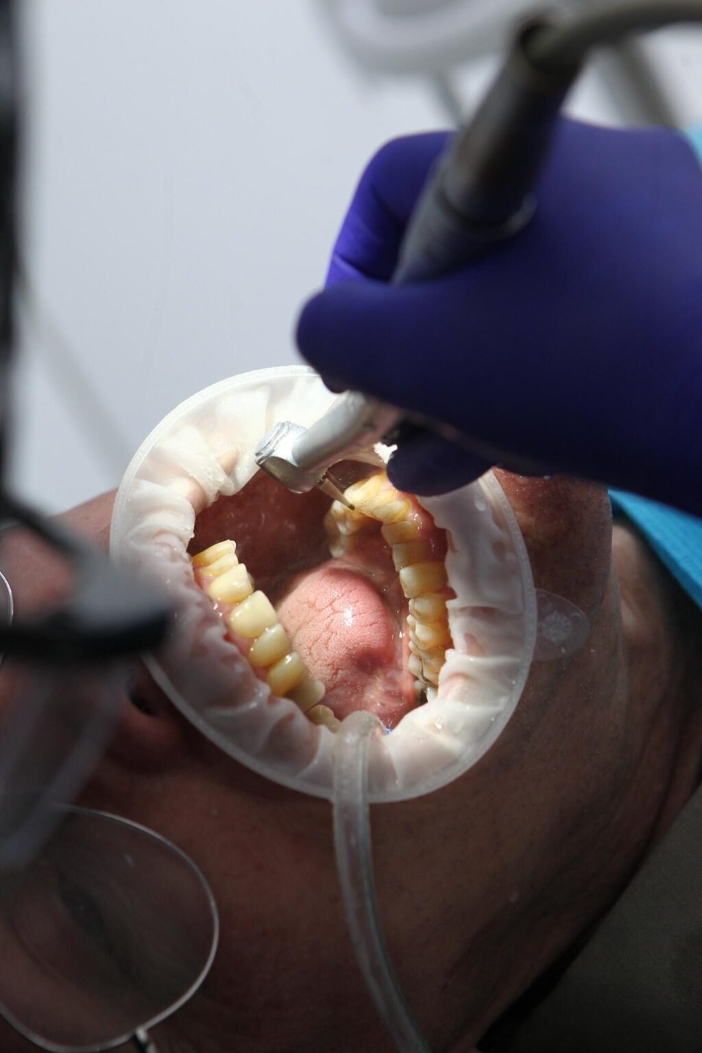 Dental Implant Specialists: Experts in Advanced Tooth Restoration ...